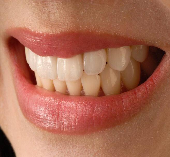 Your Neighborhood Smile Specialist - Dentist | Avon, OH | Braces ...